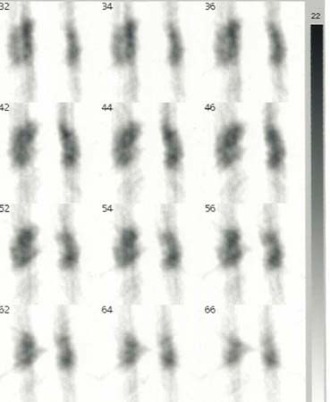Nuclear Medicine Imaging Conference