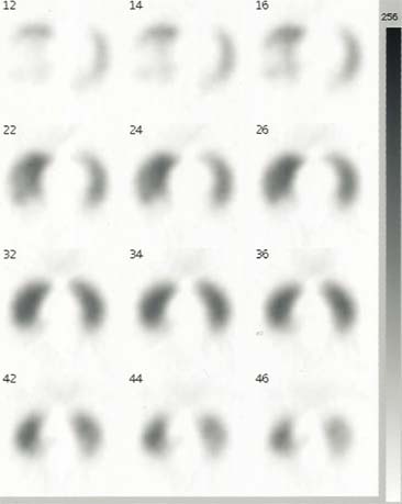 Nuclear Medicine Imaging Conference