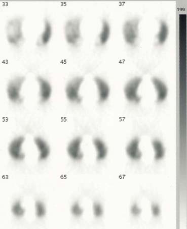Nuclear Medicine Imaging Conference
